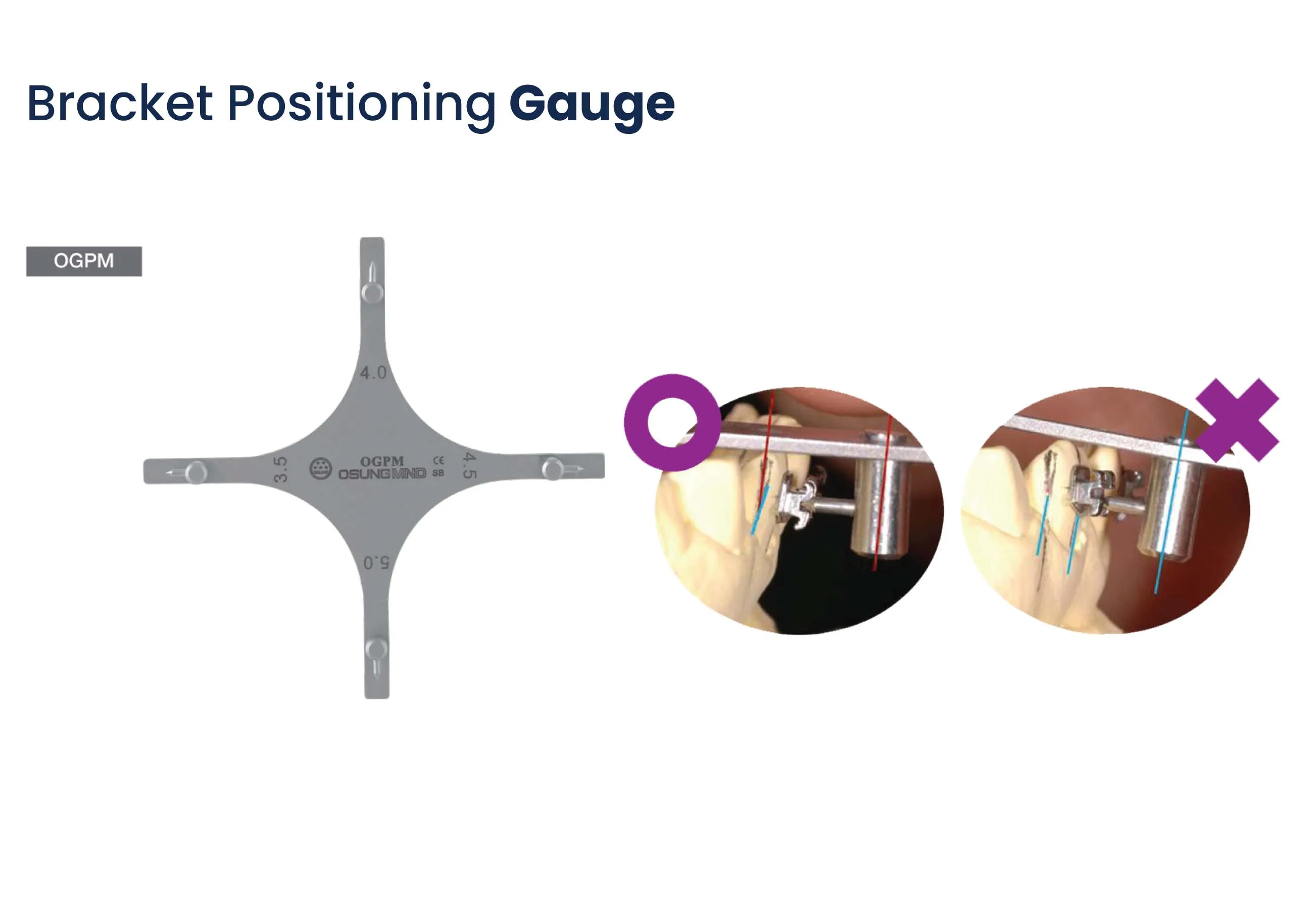 Bracket Positioning Gauge | Bracket Positioning Instrument | DENTALKU.COM